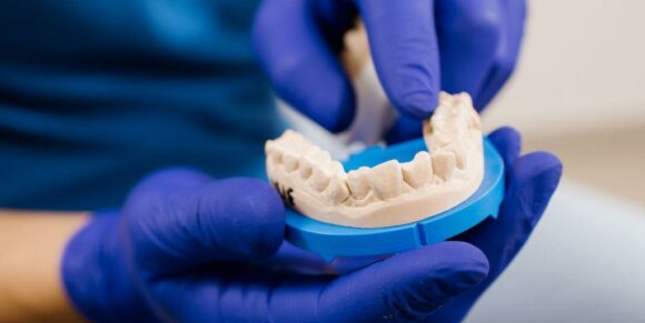 wygląda mostek Birmingham - Raty 0% | Medical-Dent